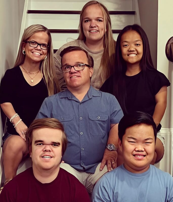 A couple with dwarfism overcame challenges to have two biological ...