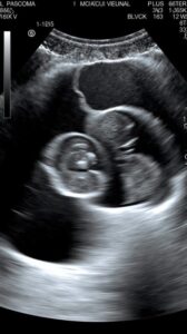 I was six months pregnant when the doctor suddenly froze, staring at ...
